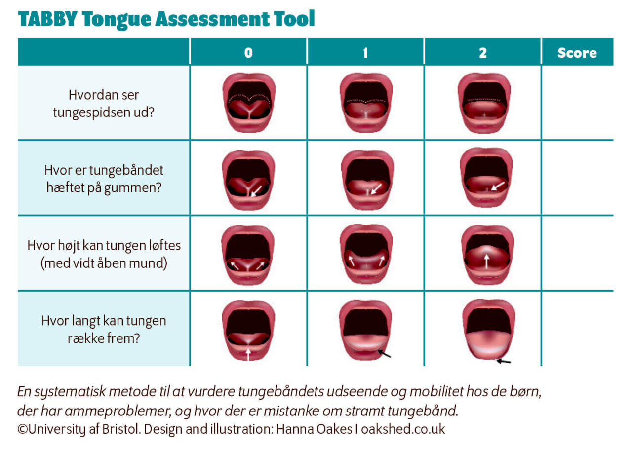 Alt om stramt tungebånd - Indlæg af ammevejleder Diana Borbely